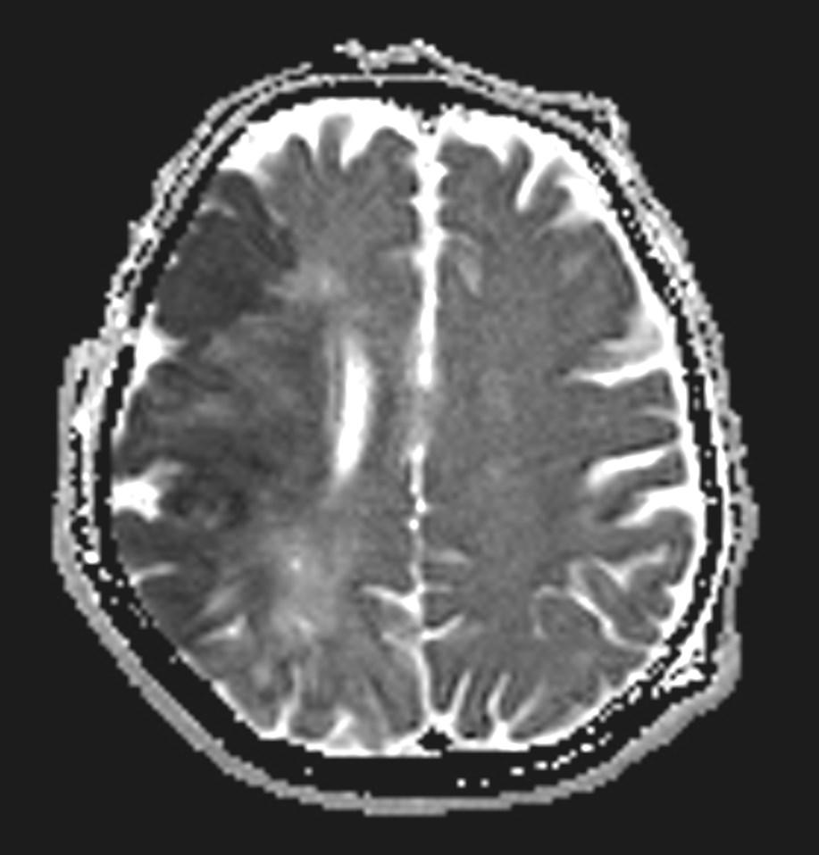 Case of the Week 22 2018 - Radiology Case Cafe